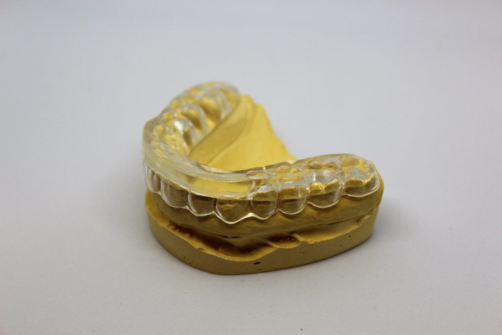 Férulas y ATM - Jordano Laboratorio Dental